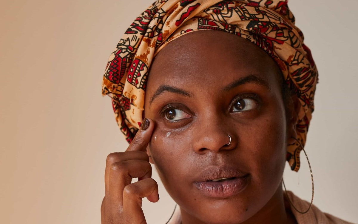 Tips For Acne Free Skin | Top Tips To Clear Up Acne | UpCircle ...