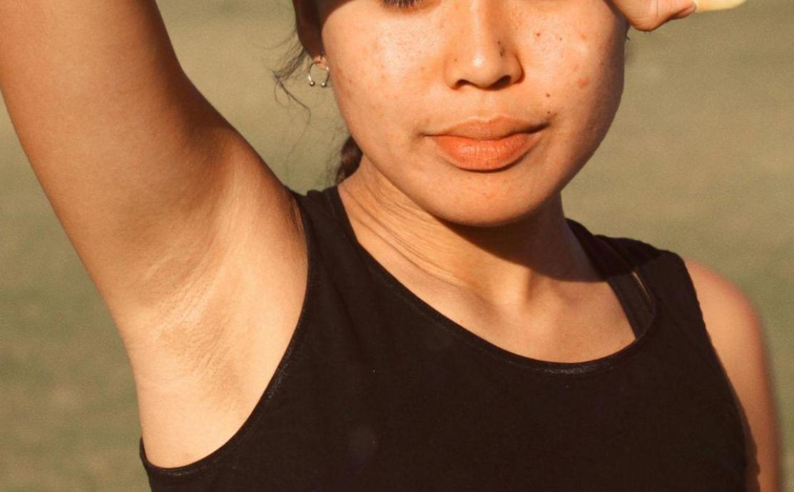 Benefits of Switching to Aluminium-Free Deodorant - UpCircle Beauty